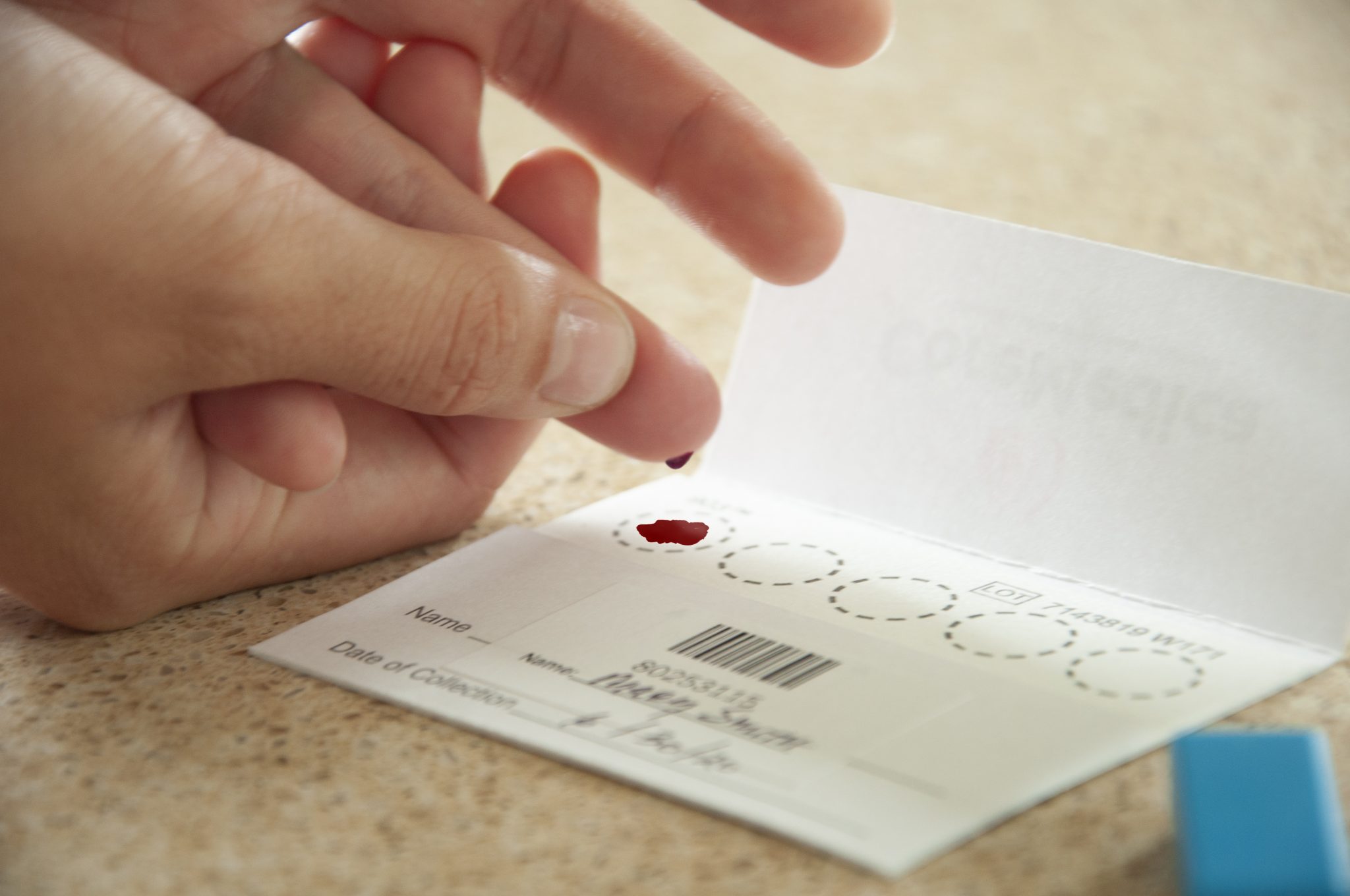 DBS (5-Spot) Card – Bioquintex Laboratories